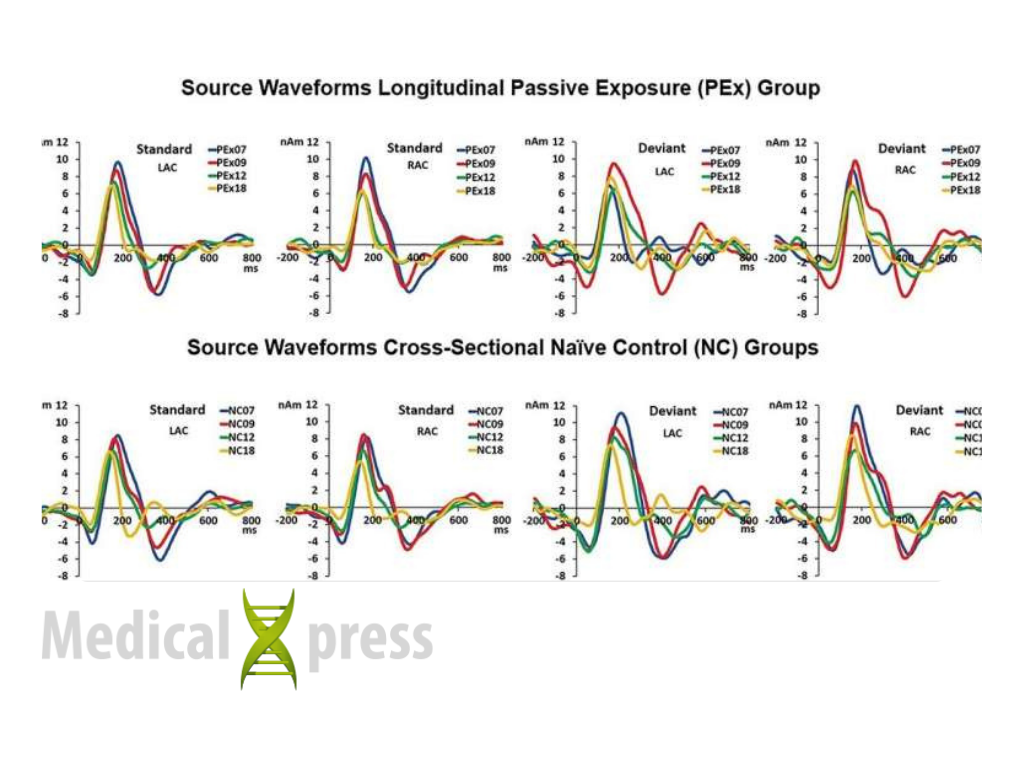 Medical Xpress: Infant exposure to brief auditory cues can support ...